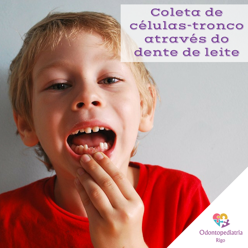 Coleta de células-tronco através do dente de leite | Odontopediatria em ...