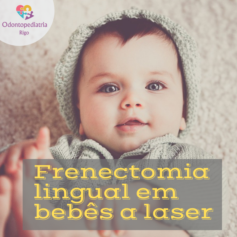 Frenectomia lingual em bebês a laser | Odontopediatria em Alphaville ...